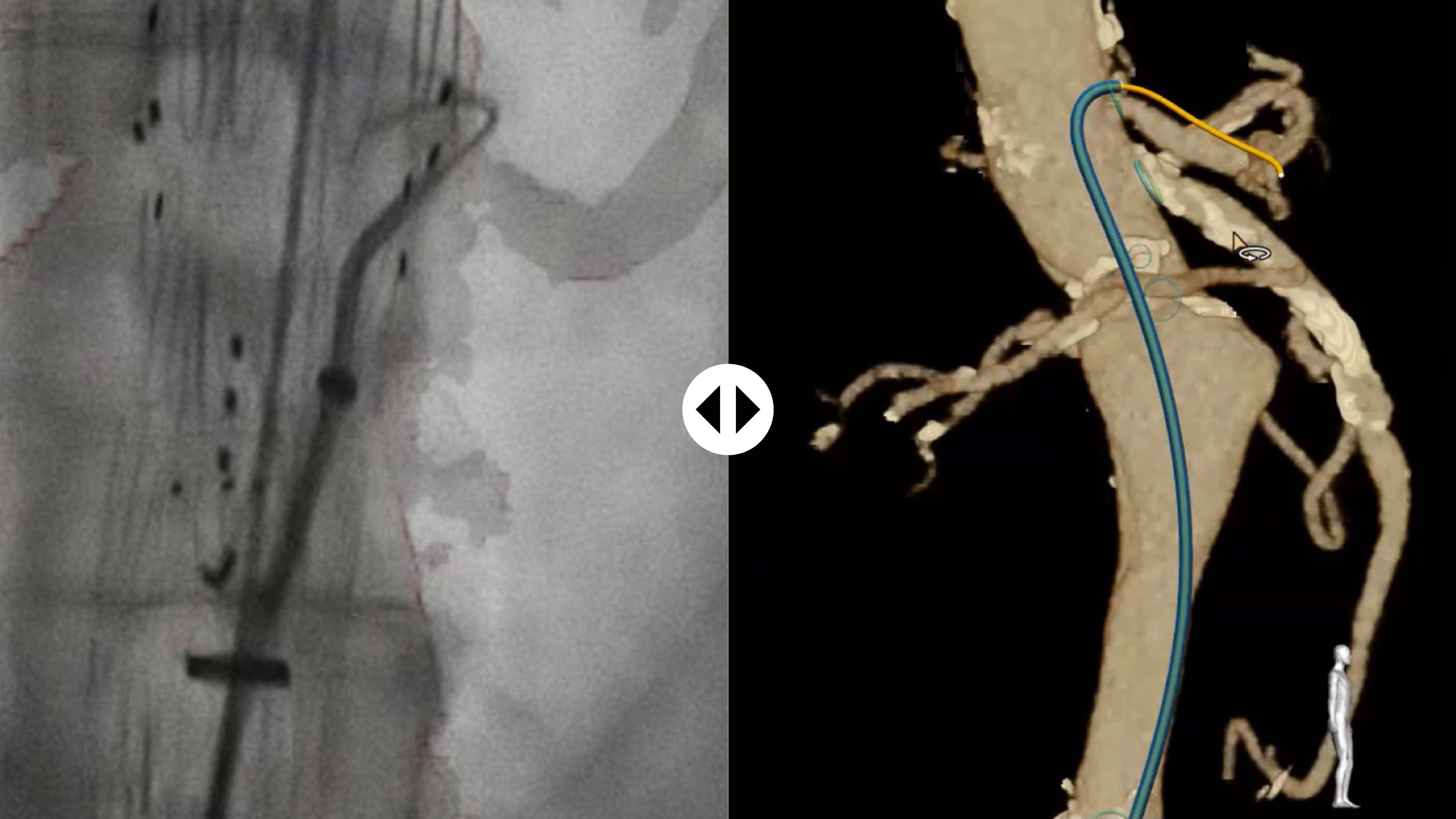 Philips Introduces Radiation-Free Vascular Imaging Technology | Applied ...